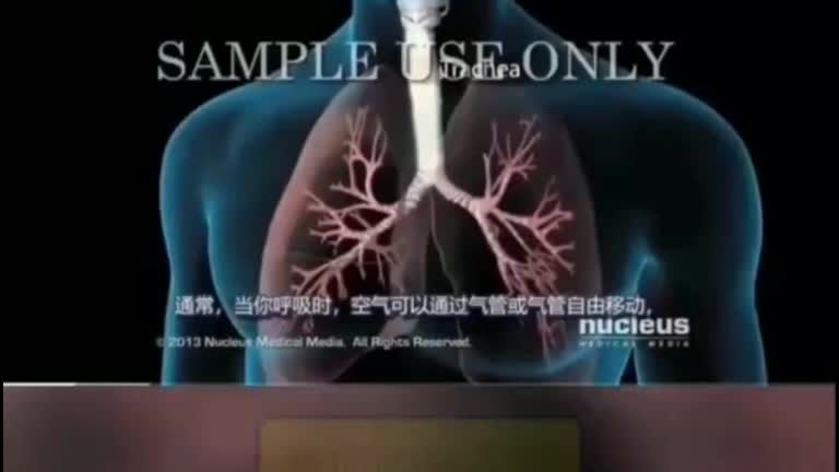 肺部结构:是由很多树状结构的支气管和肺泡构成