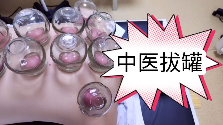 中医拔罐用途非常广泛,也非常好用!