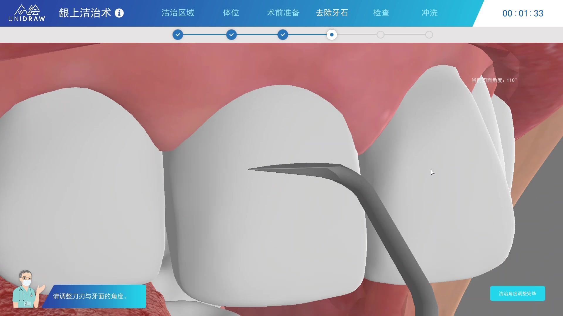 龈上洁治术3D模拟实验