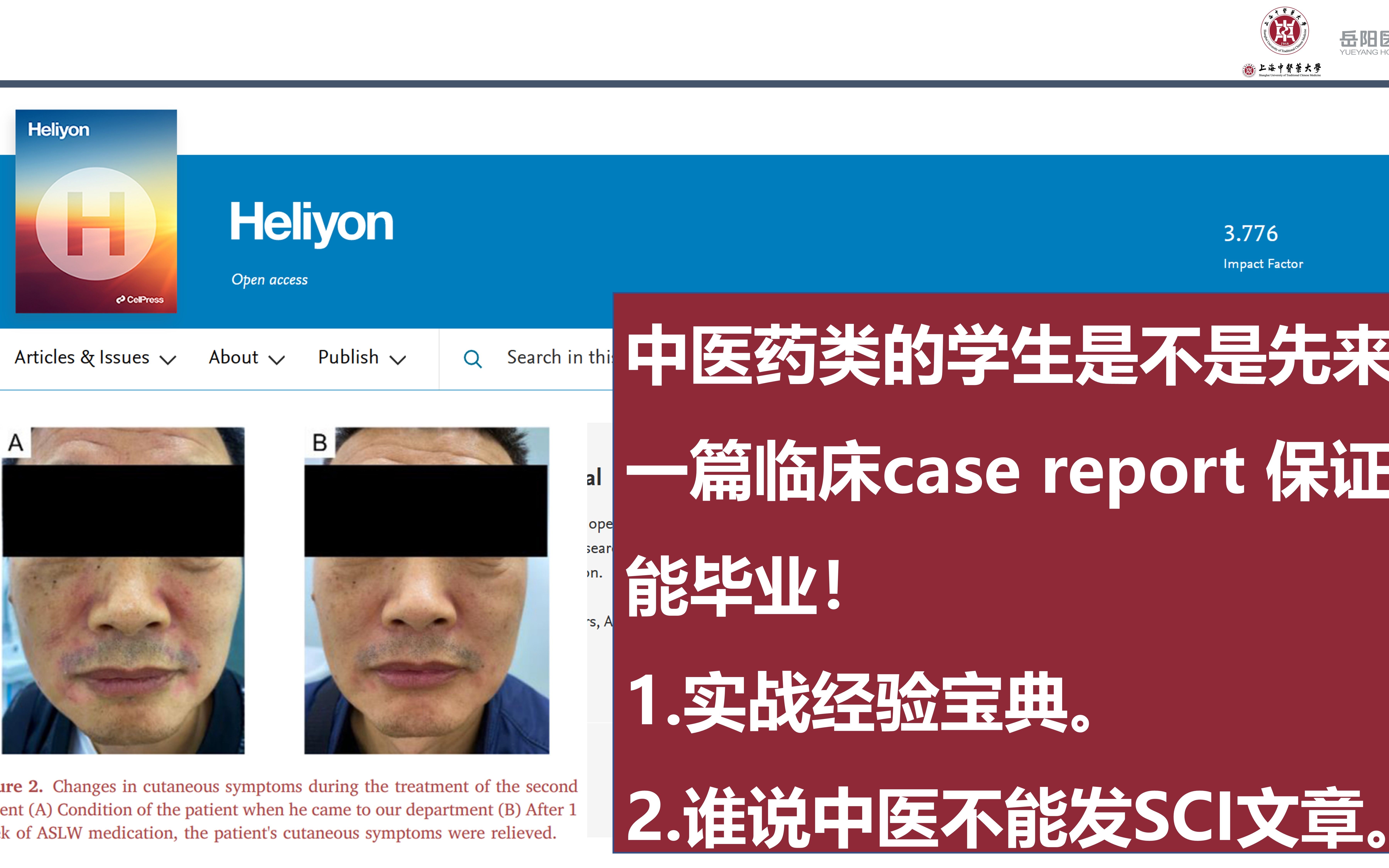 谁说中医药临床案例不能发SCI文章(经验分享)-Case Report案例一则