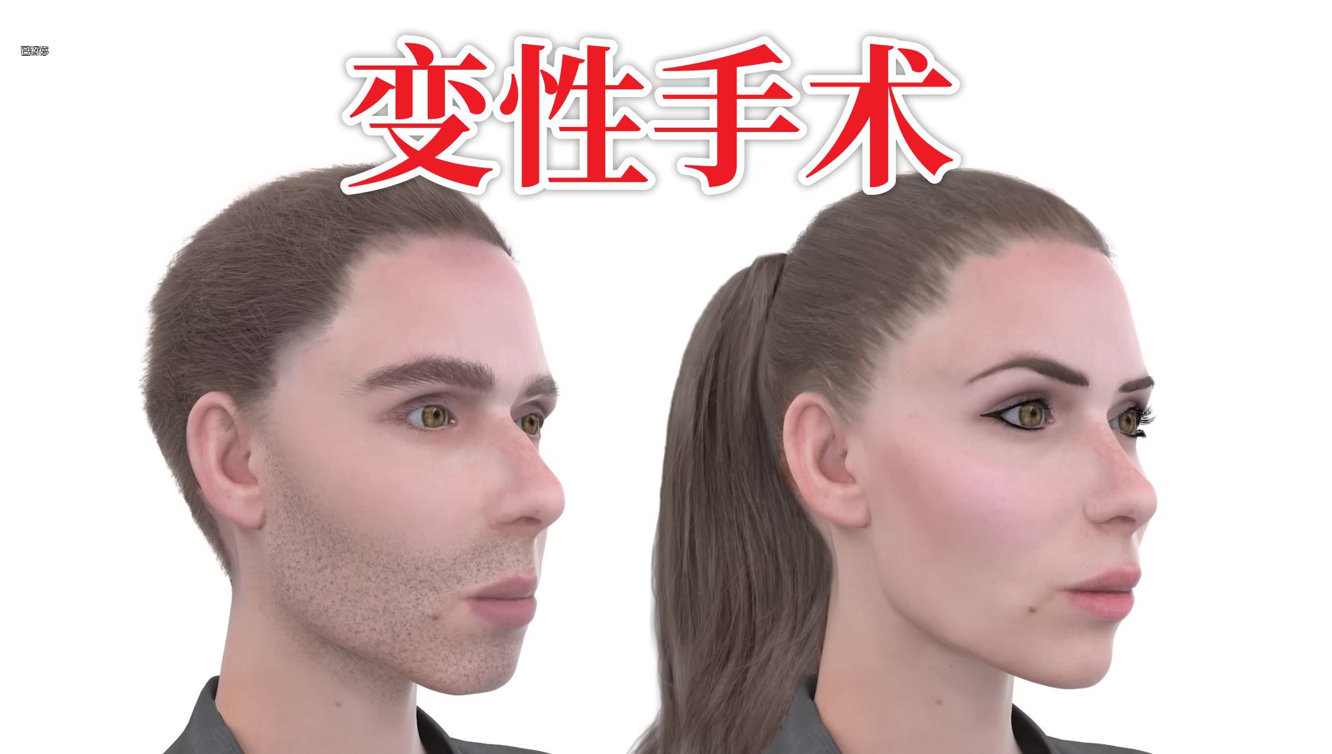 变性手术—面部【3D展示】