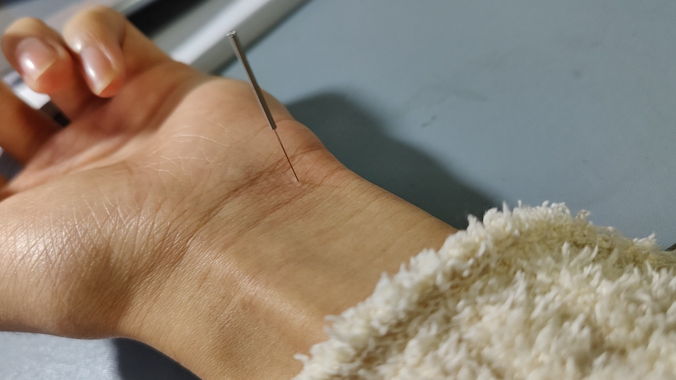 练习的日常扎神门穴