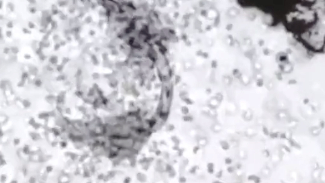 免疫细胞攻击寄生虫