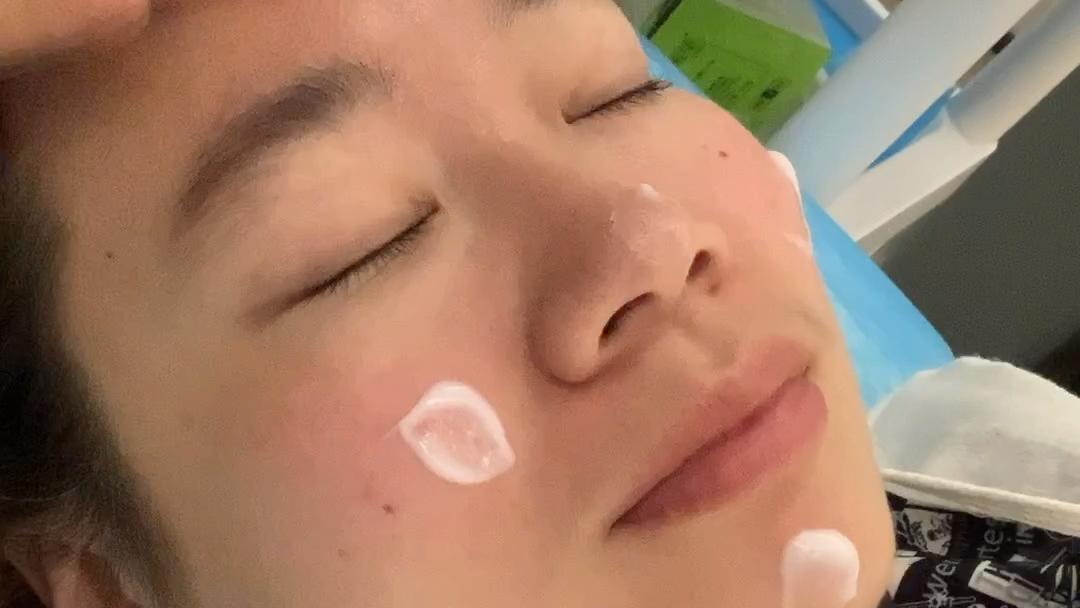 医美尝试 超皮秒全过程记录,到底有没有用