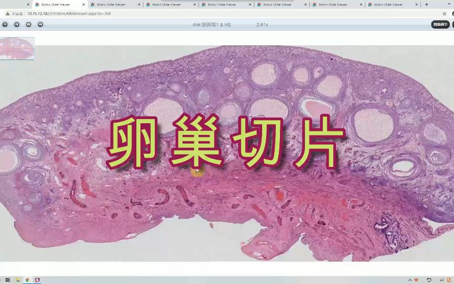 生殖腺-卵巢-组织切片解读