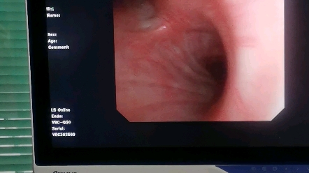 气管镜