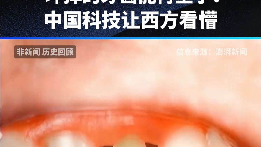 中国科技!坏掉的牙齿能再生了!