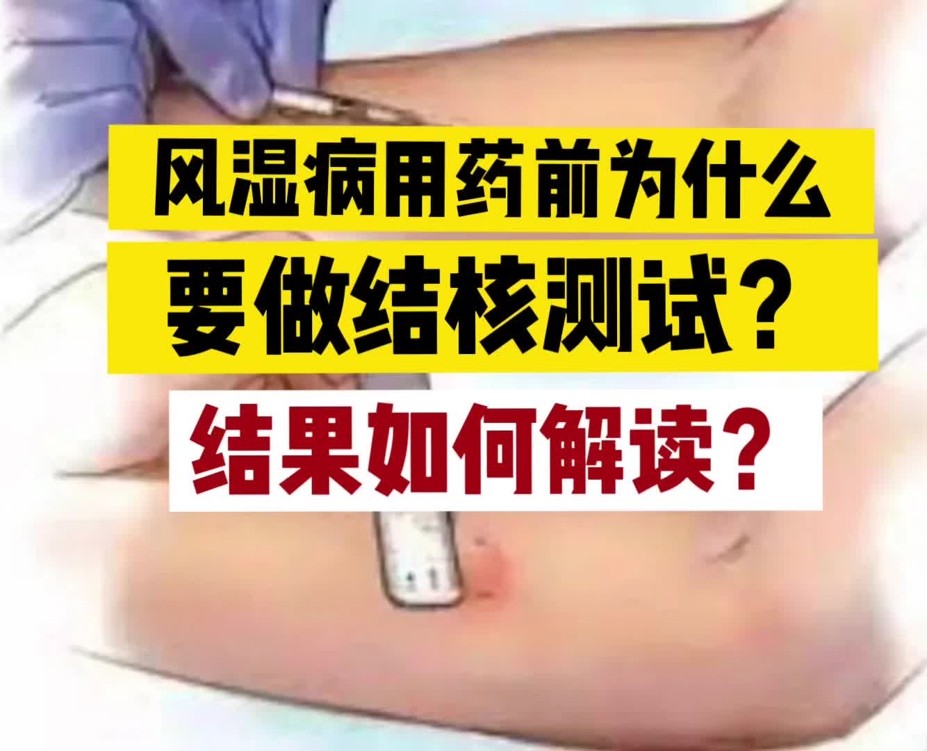 风湿病用药前为什么要做结核测试?结果如何解读? 风湿病用药前...