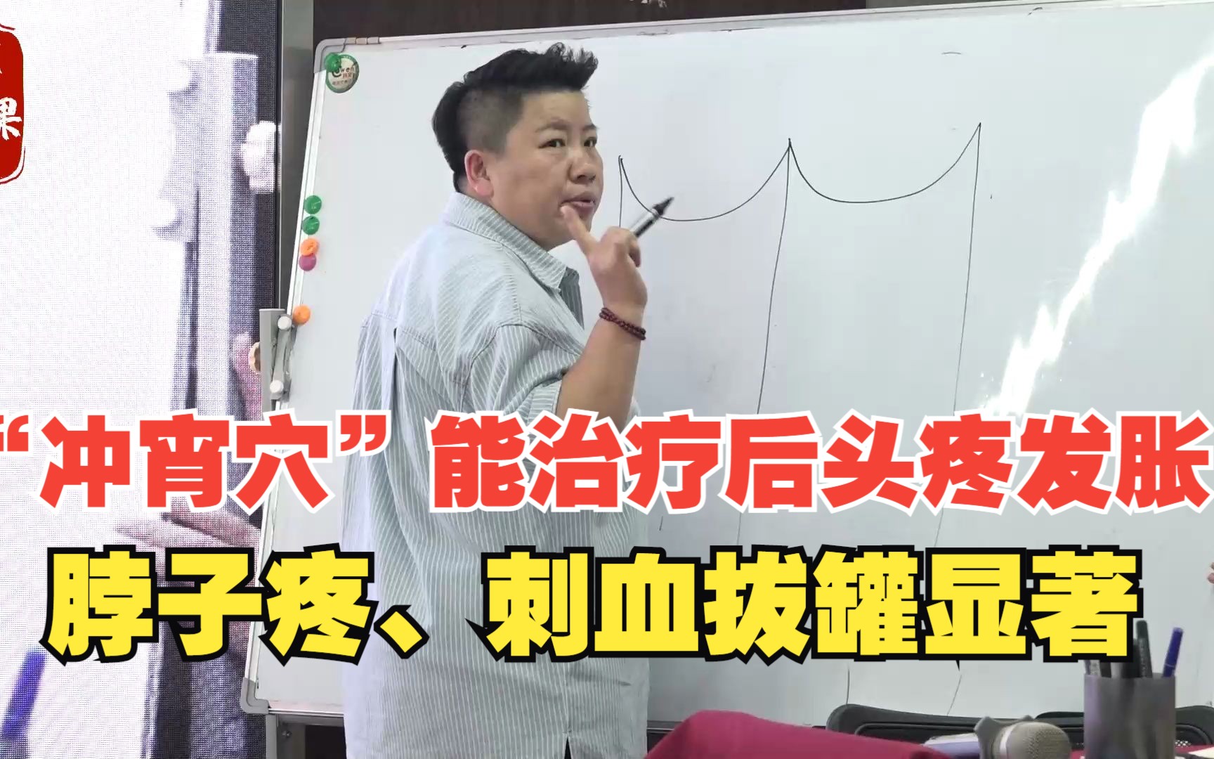 明星穴“冲宵穴”能治疗后头疼发胀、脖子疼、刺血拔罐效果显著
