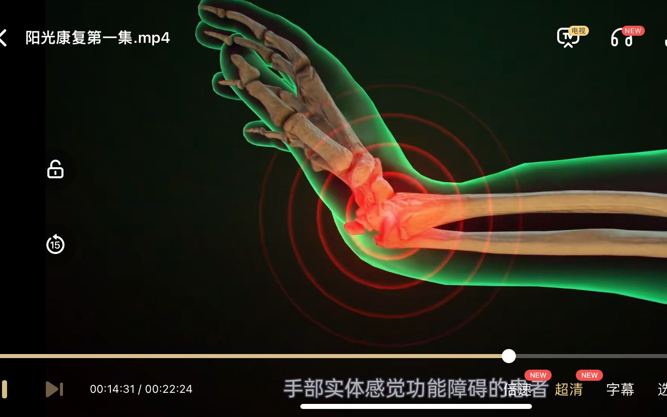 职业康复工作站模拟训练(上)