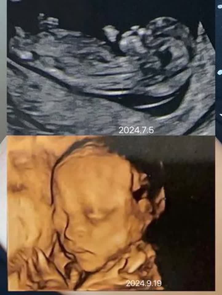 你从什么时候开始感受到幸福啊?大概是你在我肚子里第一次胎动的...