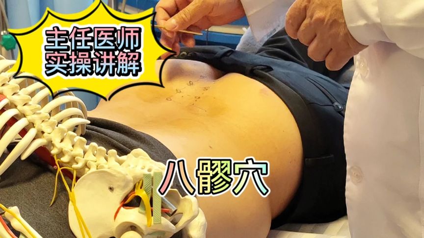 针灸科病案分享 :八髎穴,定位取穴,针灸实操精讲!