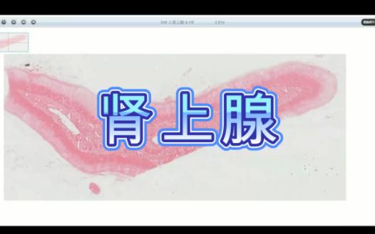 内分泌-肾上腺-组织切片解读