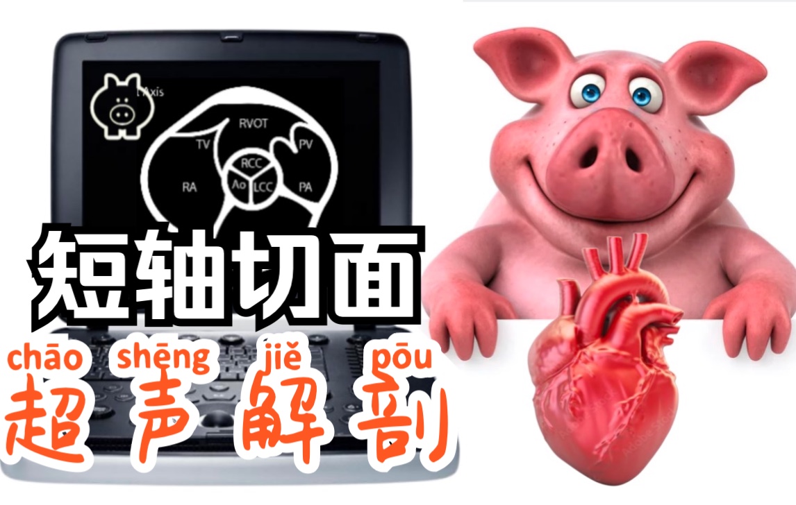 心脏超声-胸骨旁短轴切面(心脏解剖)
