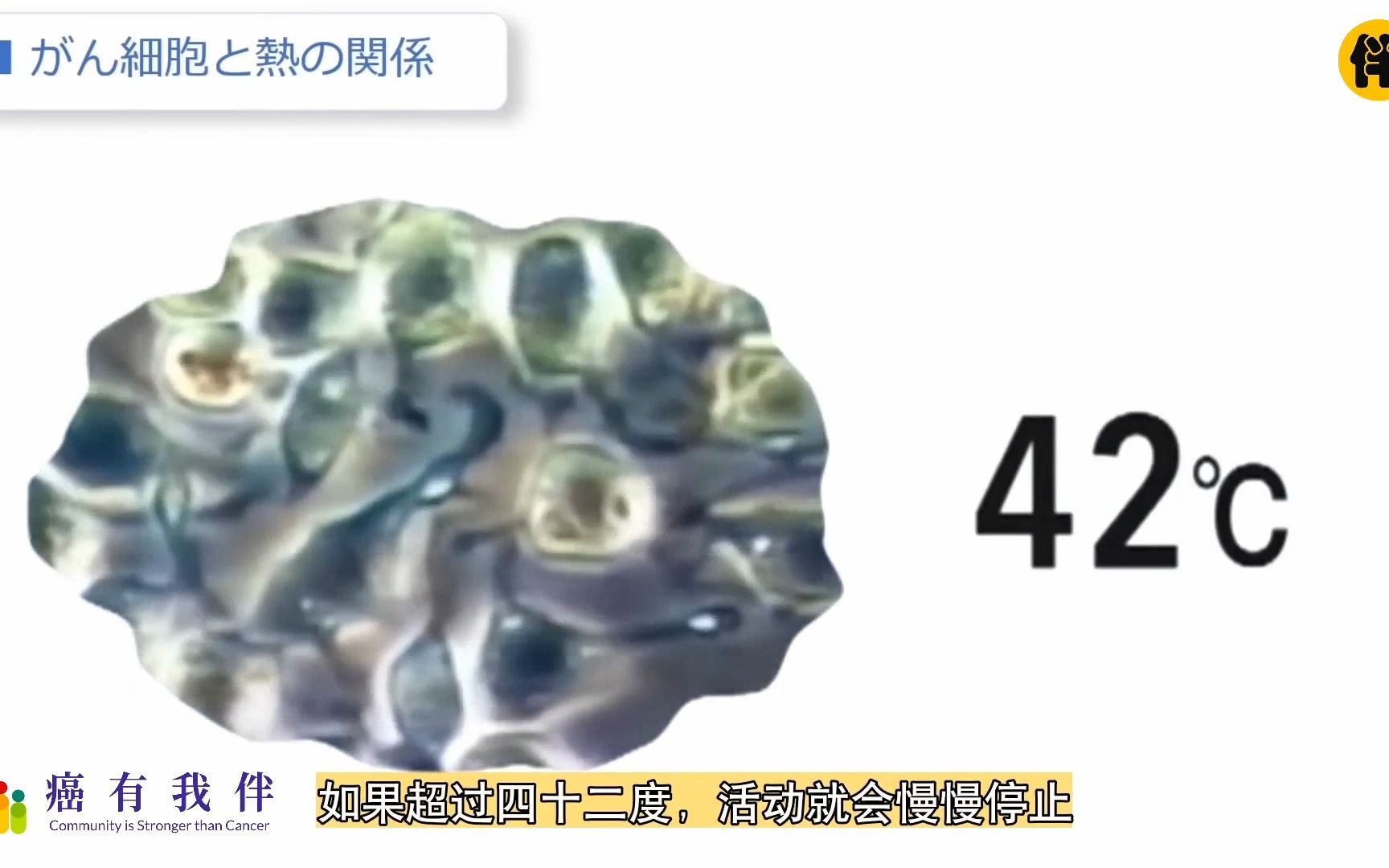 日本肿瘤电离子温热治疗原理 低剂量化疗