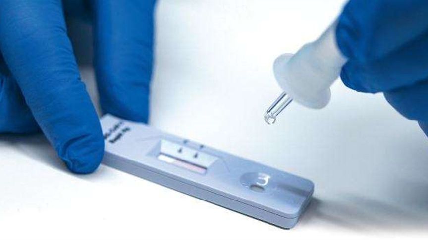 国家医保局:新冠抗原检测收费总额不得高于每人次15元