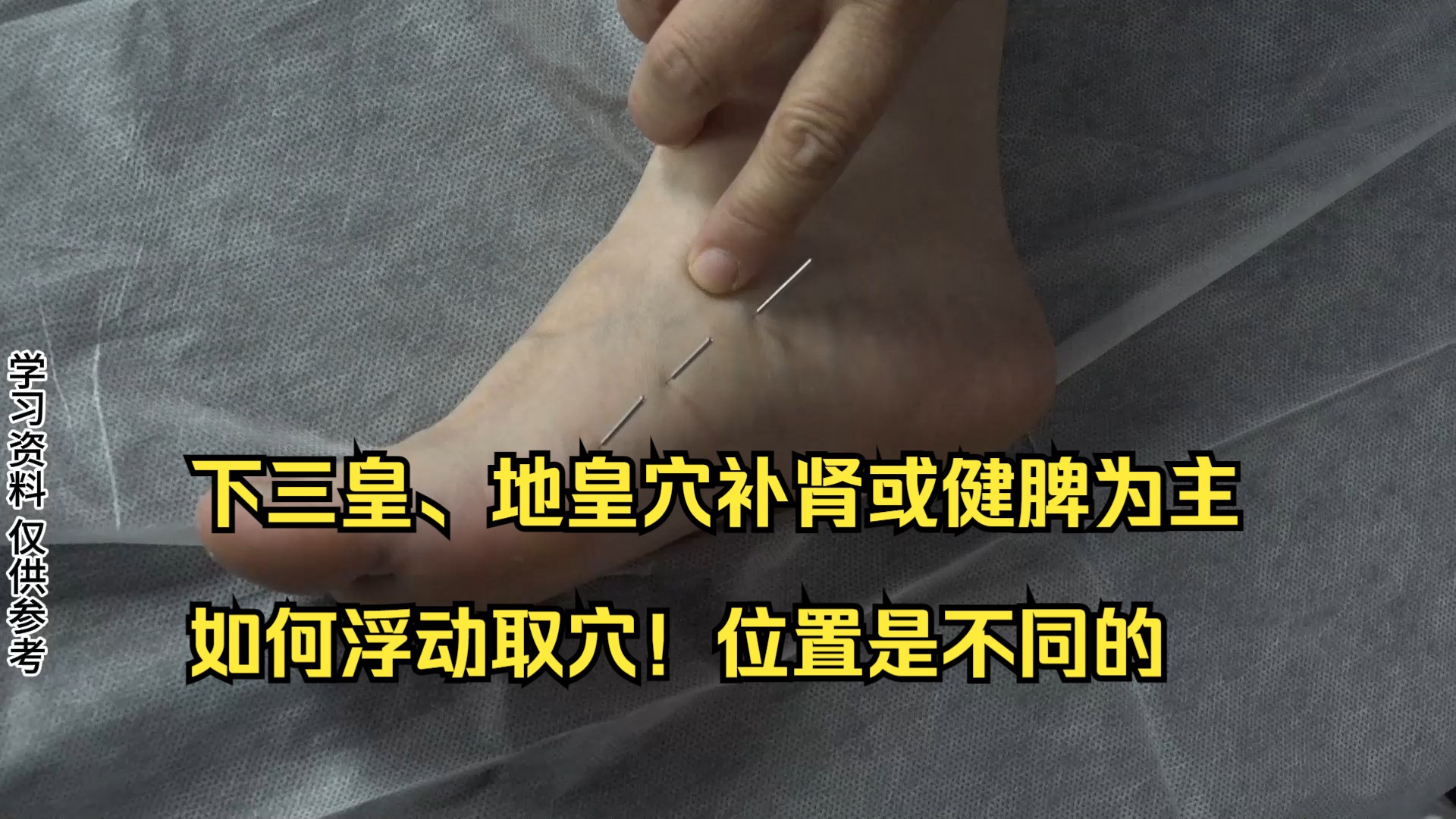 下三皇、地皇穴补肾或健脾为主,如何浮动取穴!位置是不同的