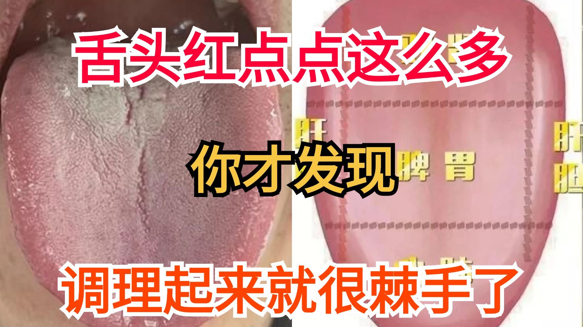舌头红点点这么多,你才发现!调理起来就很棘手了