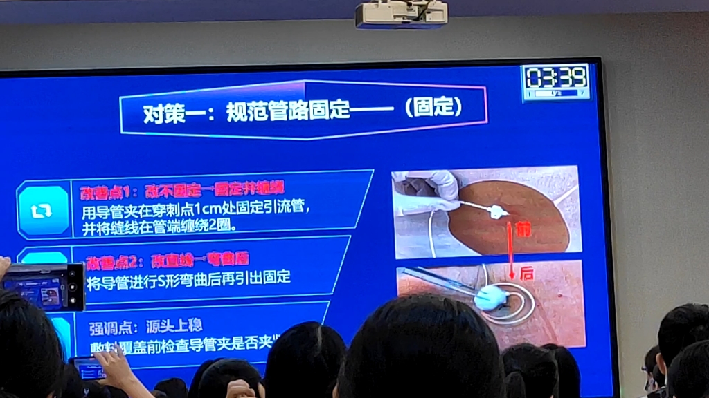 获奖护理个案分享