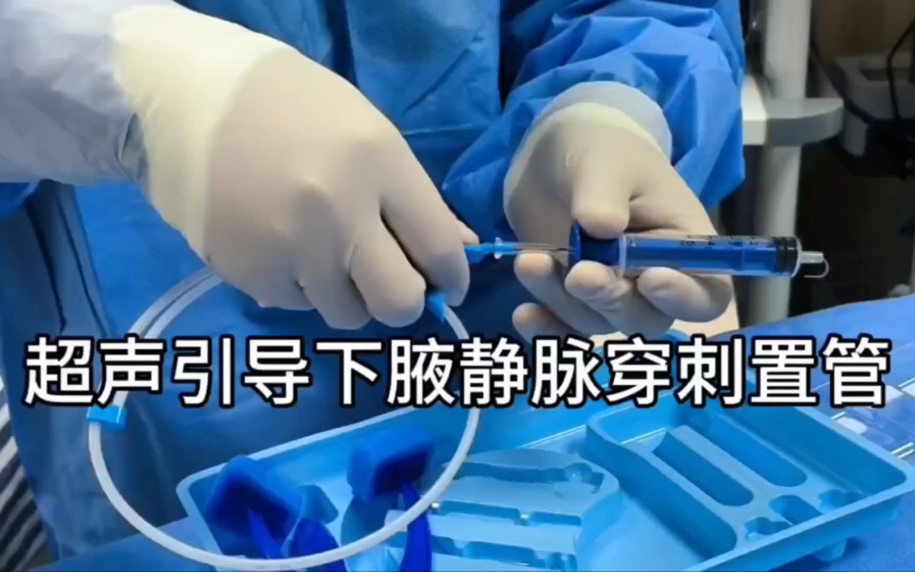 超声引导下腋静脉穿刺置管