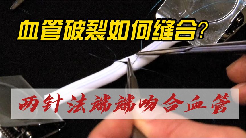 血管破裂如何缝合?| 两针法端端吻合血管