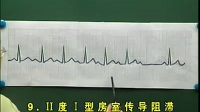 怎样看心电图在线观看-心电图讲座