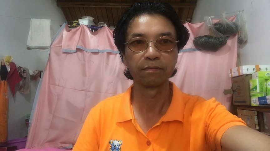 再次扎针地神穴治疗男性勃起困难的疾病今天扎右手。