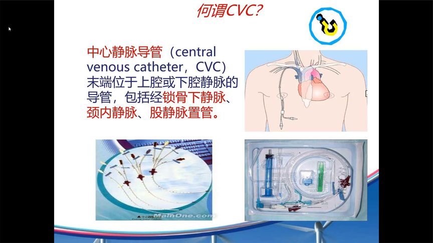 中心静脉导管(CVC)的维护PPT