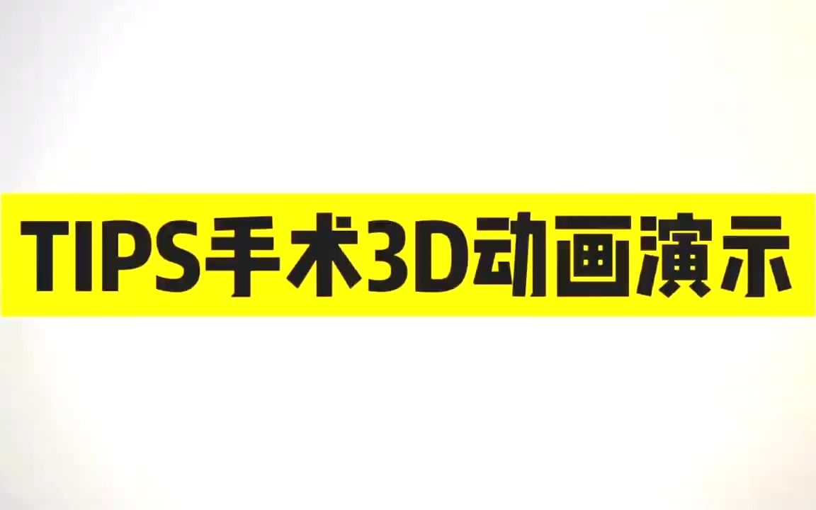 乙肝,肝硬化,门静脉高压,TIPS手术如何做,3D动画演示一目了然
