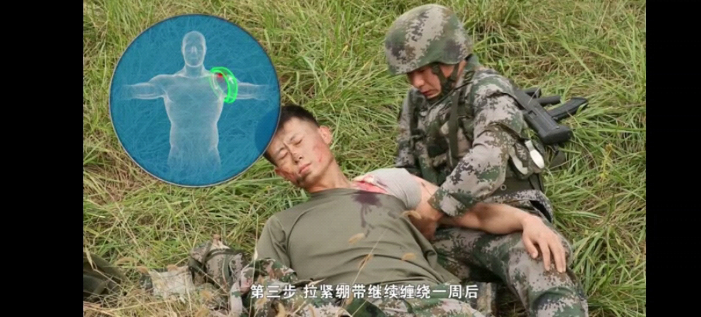 战伤救护教学——急救创伤绷带8字包扎法