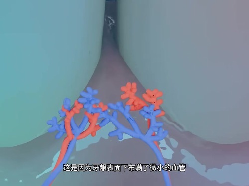 发明牙线的真是个天才,为什么使用牙线会出血呢