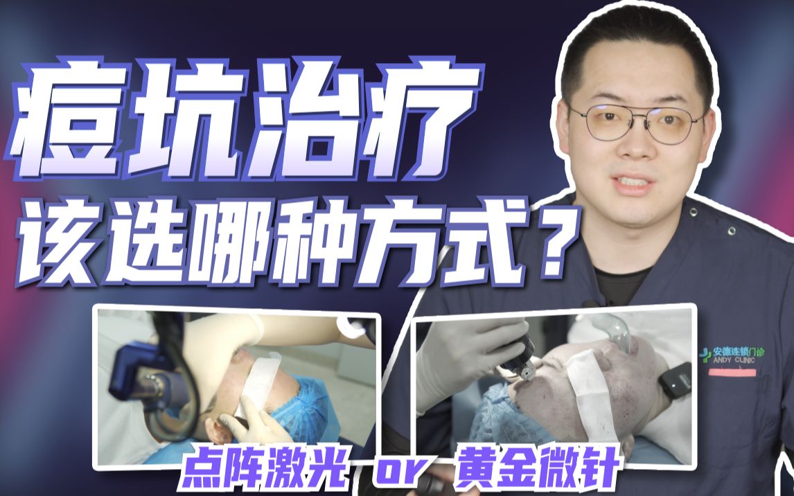【痘坑治疗】6个维度告诉你点阵激光和黄金微针该如何选择!
