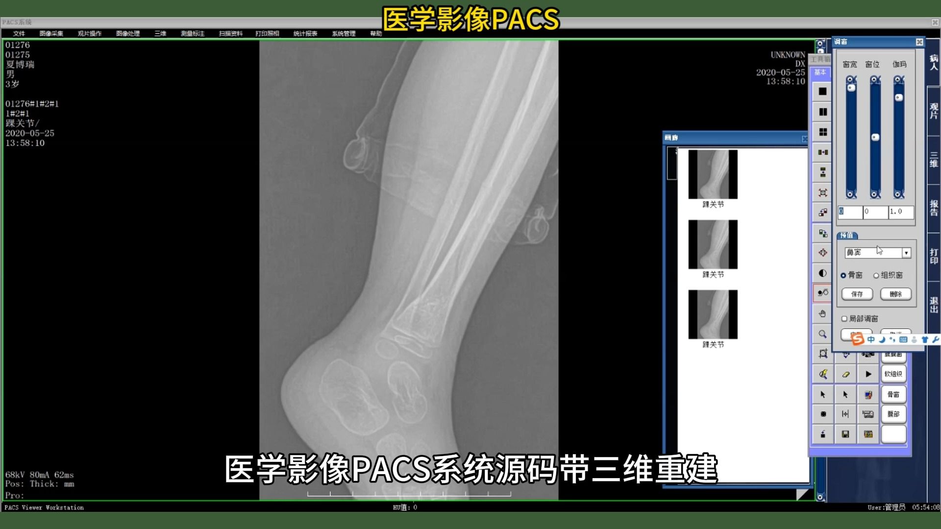 医学影像PACS带三维重建