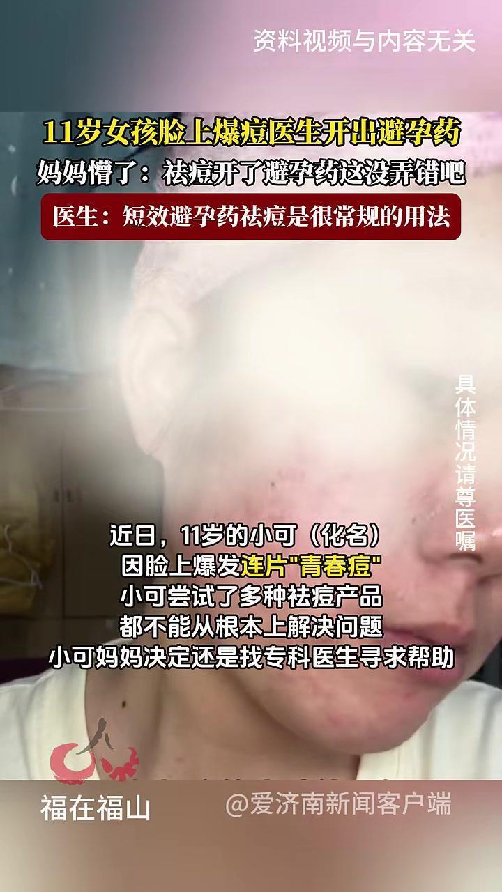 11岁女孩脸上爆痘,医生开出避孕药,妈妈懵了:祛痘开了避孕药,这没弄错...