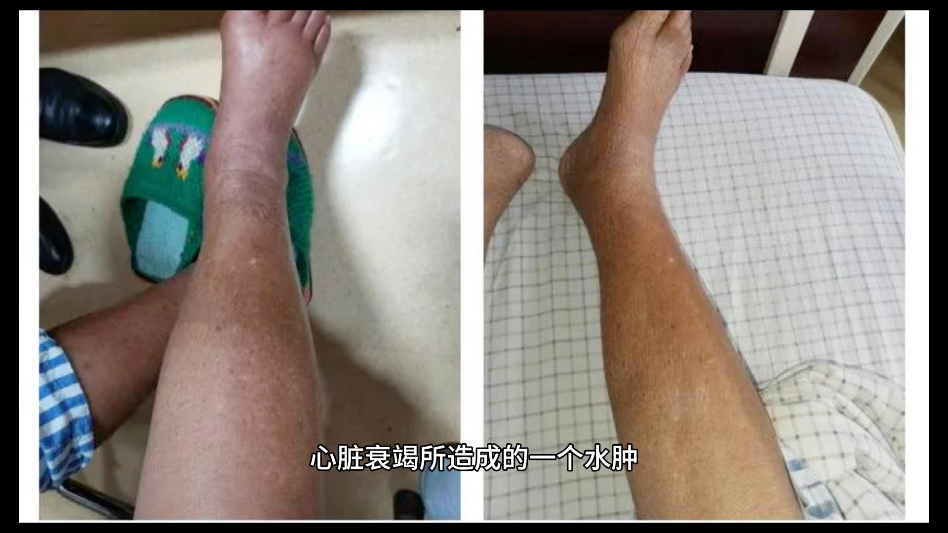 维生素对人体的重要