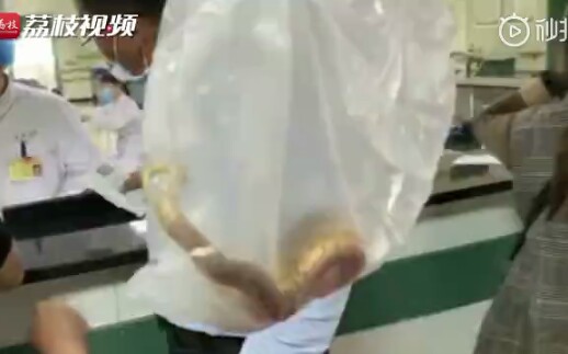 被毒蛇咬后的教科书式自救!大妈斩杀毒蛇带蛇尸体就医