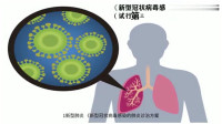 新型病毒来袭,如何区分普通感冒,流感和病毒性肺炎