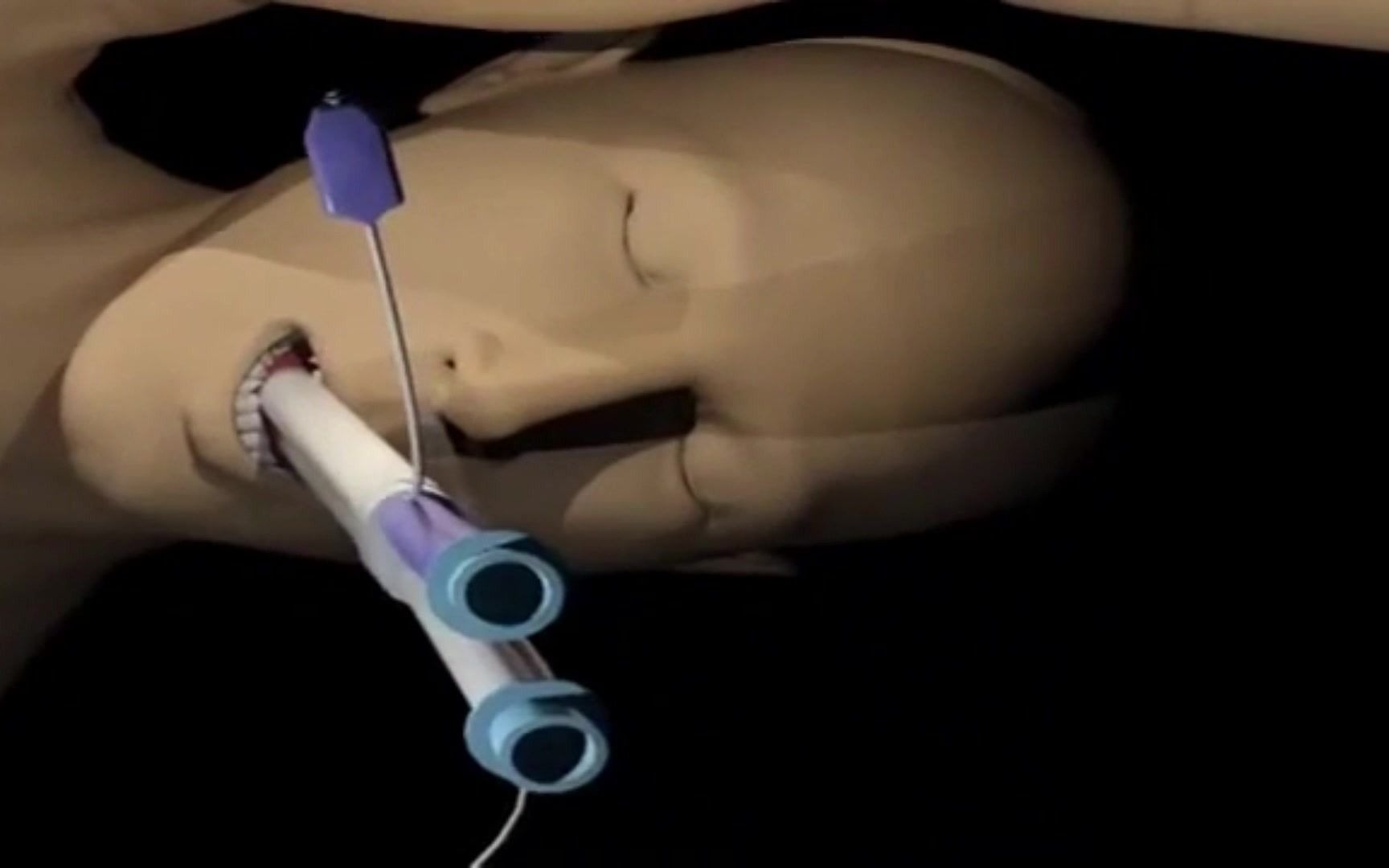 医学动画:通过VATS手术进行右肺气肿大疱切除
