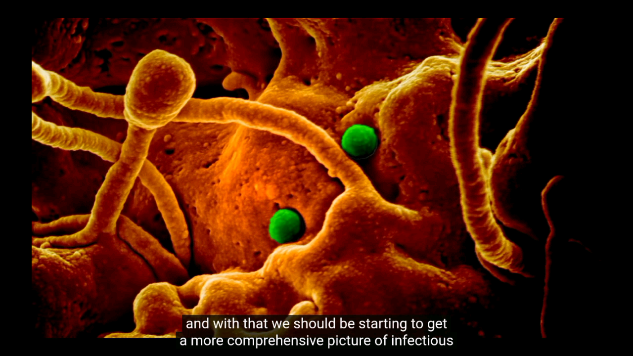 显微镜发展历史