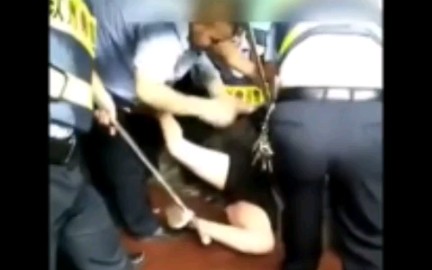 女子被人类最忠诚的朋友咬伤后开始学狗叫,见人就攻击!