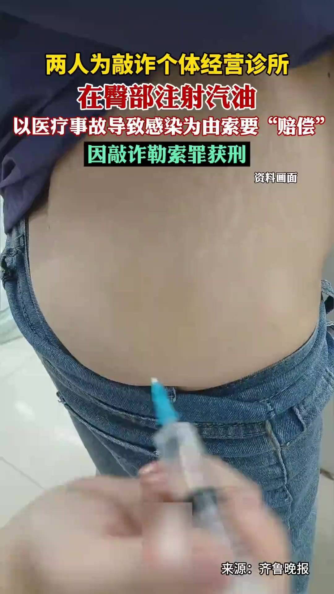 ...敲诈个体经营诊所,在臀部注射汽油,以医疗事故导致感染为由索要"赔偿"