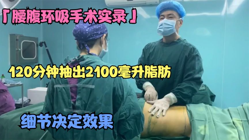 「腰腹环吸手术实录」120分钟抽出2100毫升脂肪,细节决定效果