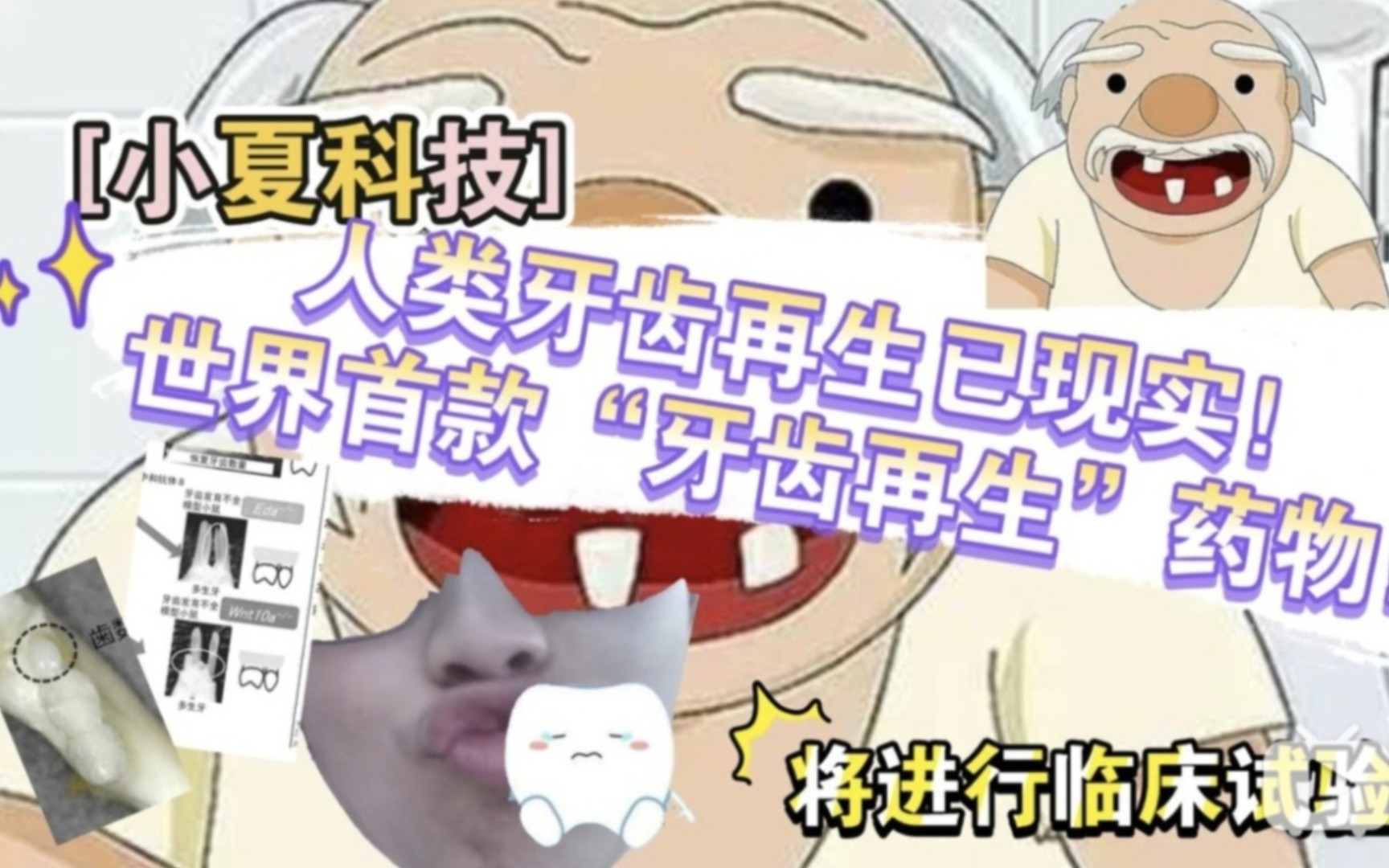 [小夏科技]人类牙齿再生成现实?世界首款“牙齿再生”药物将进行临床...