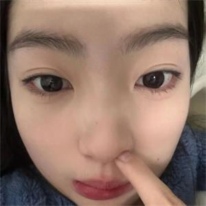 斑斑总动员
