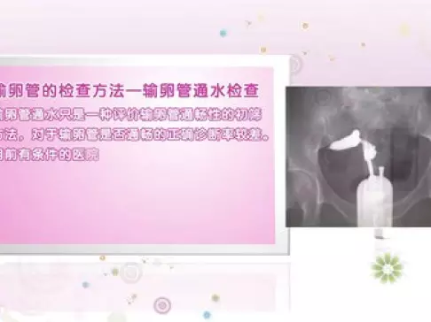 妇科——不孕不育——详解输卵管性不孕症(中)