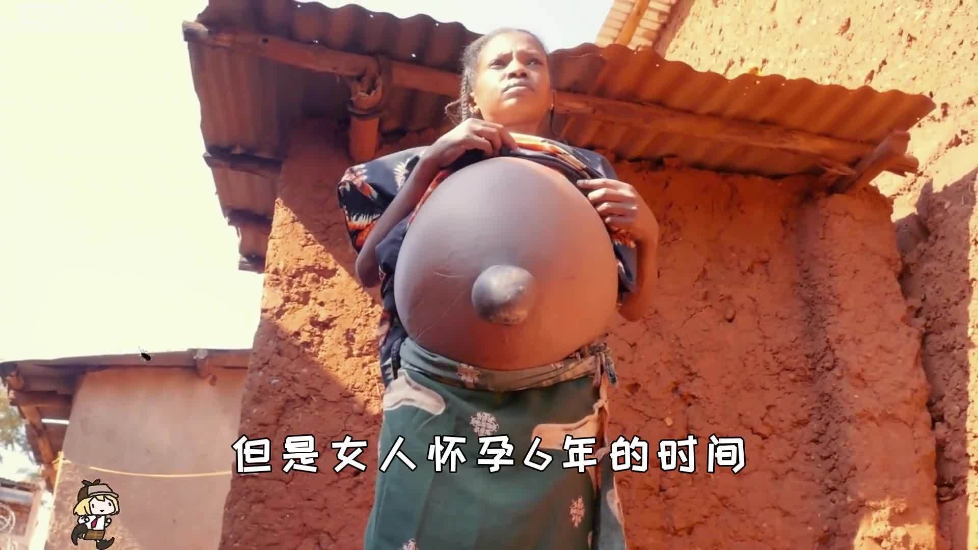 女人怀孕六年都没生产,比哪吒还哪吒,身体毫无分娩迹象!