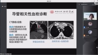 中等长度导管相关血栓的防治