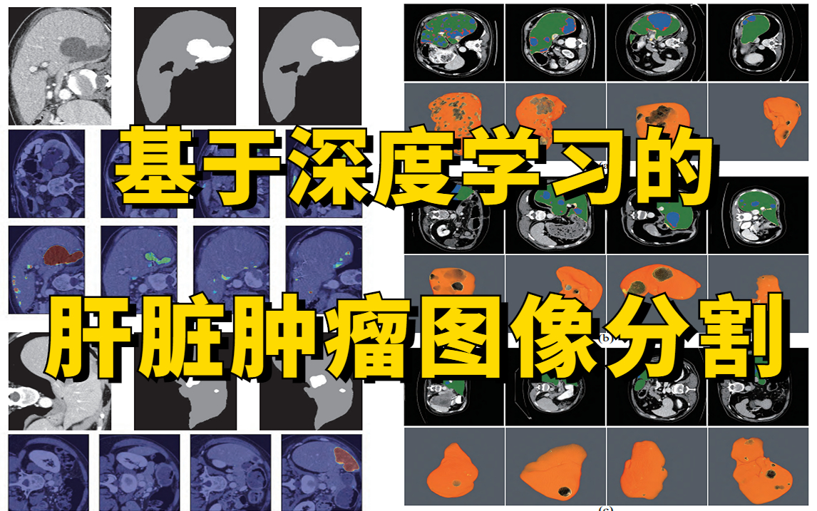 医学图像处理实战教程:基于深度学习实现肝脏肿瘤图像分割,从环境...