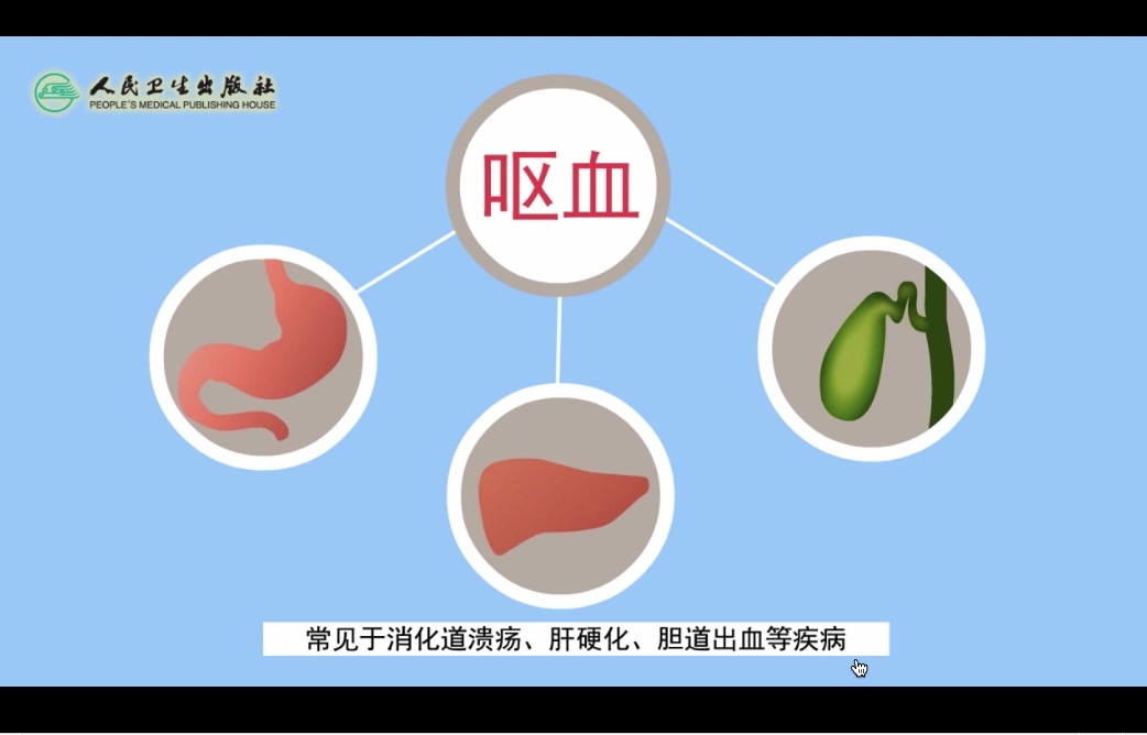 咯血与呕血的鉴别
