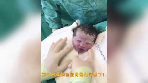 剖腹产手术进行到一半时,医生意外停顿,宝宝内心瞬间动摇